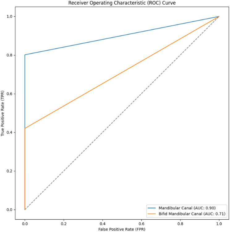 AI-powered segmentation of bifid mandibular canals using CBCT - PMC