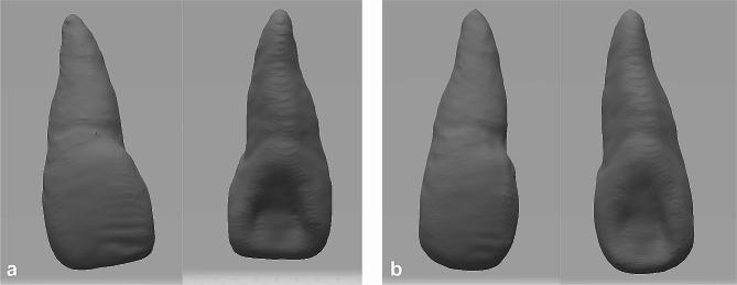 Accuracy and efficiency of dynamic navigated root-end resection in endodontic surgery: a pilot ...