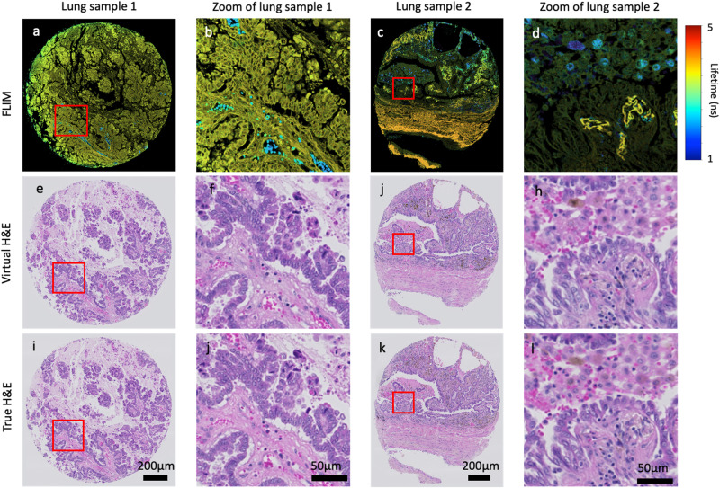 Deep learning-based virtual H& E staining from label-free autofluorescence lifetime images - PMC