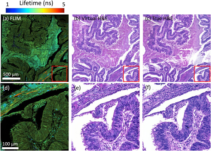 Deep learning-based virtual H& E staining from label-free autofluorescence lifetime images - PMC