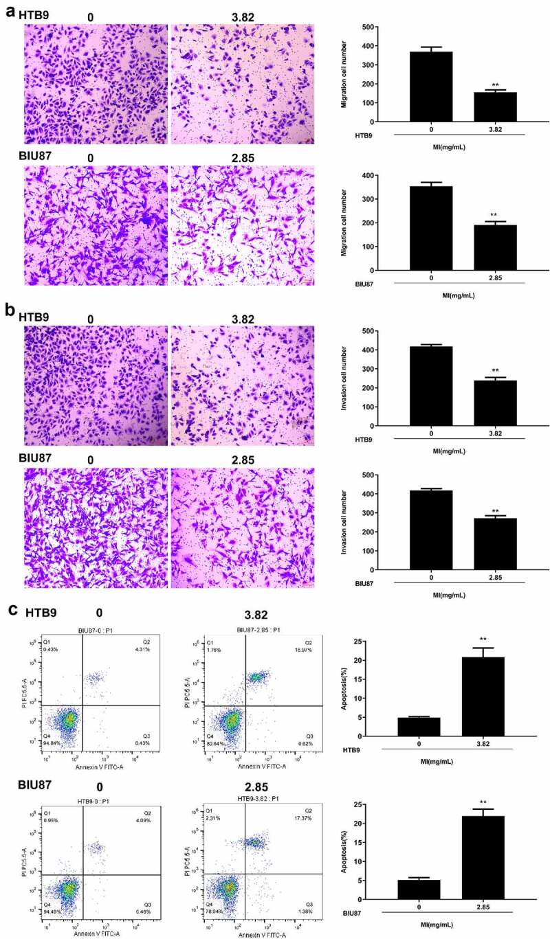 Magnesium isoglycyrrhizinate suppresses bladder cancer progression by ... Magnesium isoglycyrrhizinate suppresses bladder cancer progression by ...