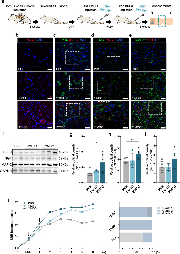 Stepwise combined cell transplantation using mesenchymal stem cells and induced pluripotent stem ...