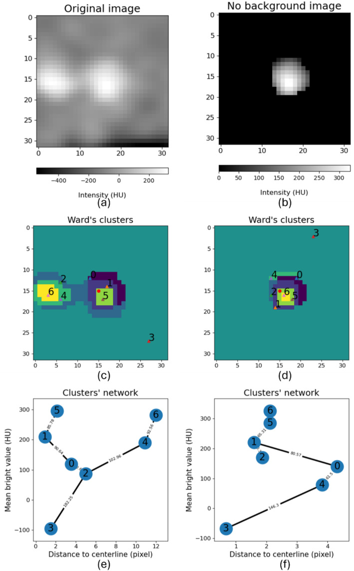 Unsupervised clustering based coronary artery segmentation - PMC