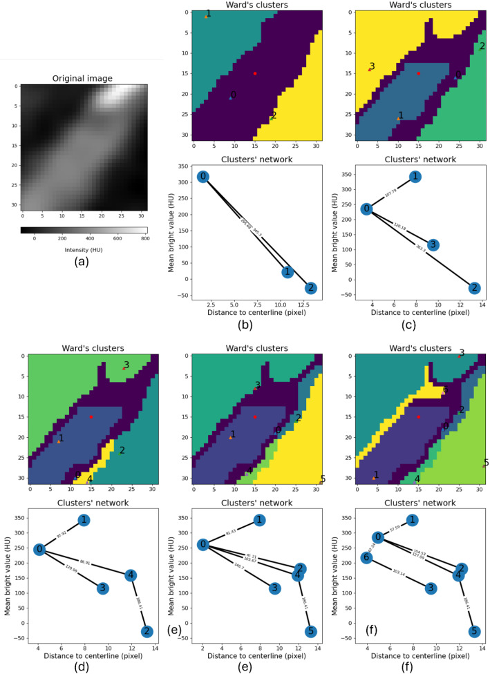 Unsupervised clustering based coronary artery segmentation - PMC