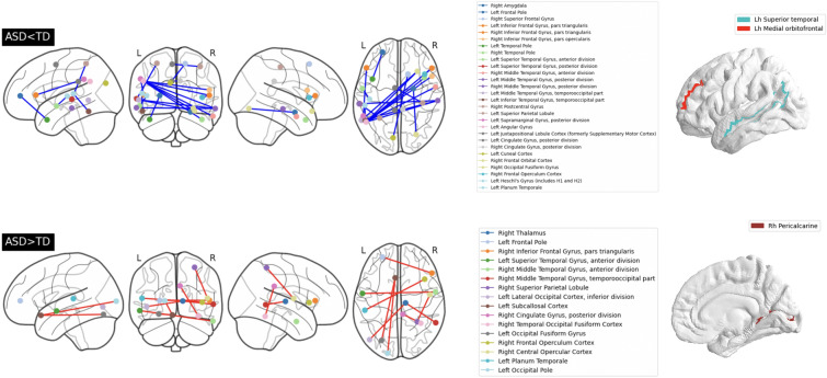 Deep learning based joint fusion approach to exploit anatomical and functional brain information ...