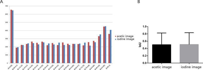 The application of deep learning based diagnostic system to cervical squamous intraepithelial ...