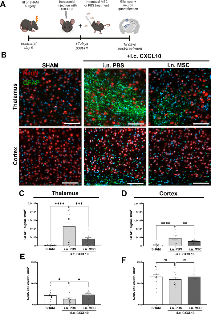 CXCL10 is a crucial chemoattractant for efficient intranasal delivery of mesenchymal stem cells ...