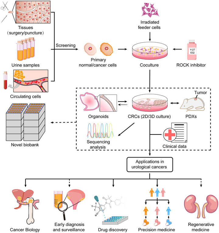 Conditional reprogramming: Modeling urological cancer and translation to clinics - PMC