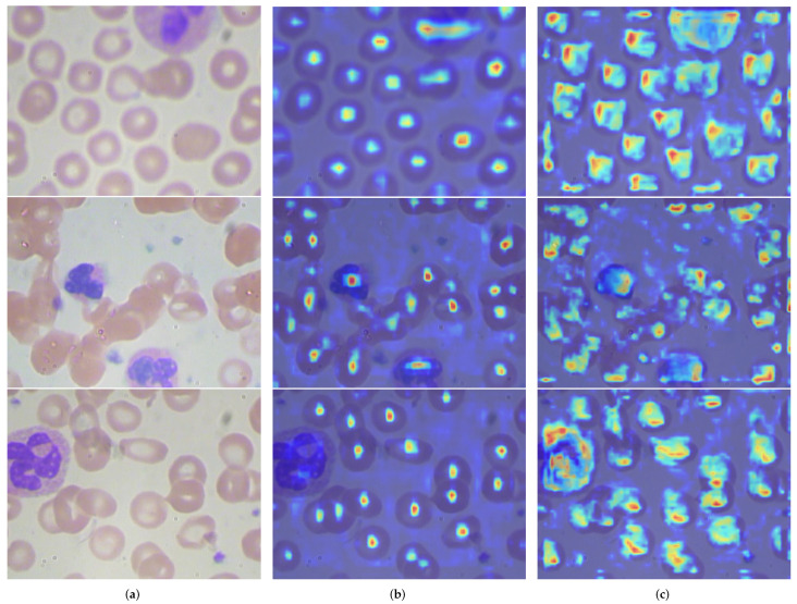 TW-YOLO: An Innovative Blood Cell Detection Model Based on Multi-Scale ...