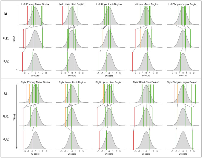 Inconsistent primary motor cortex glucose hypometabolism in primary lateral sclerosis - PMC