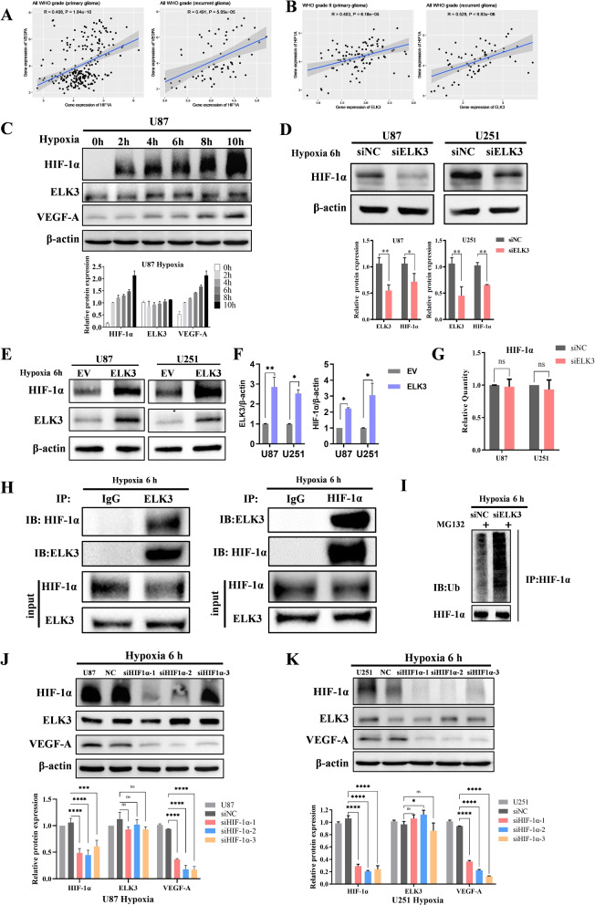 Glioma angiogenesis is boosted by ELK3 activating the HIF-1α/VEGF-A signaling axis - PMC