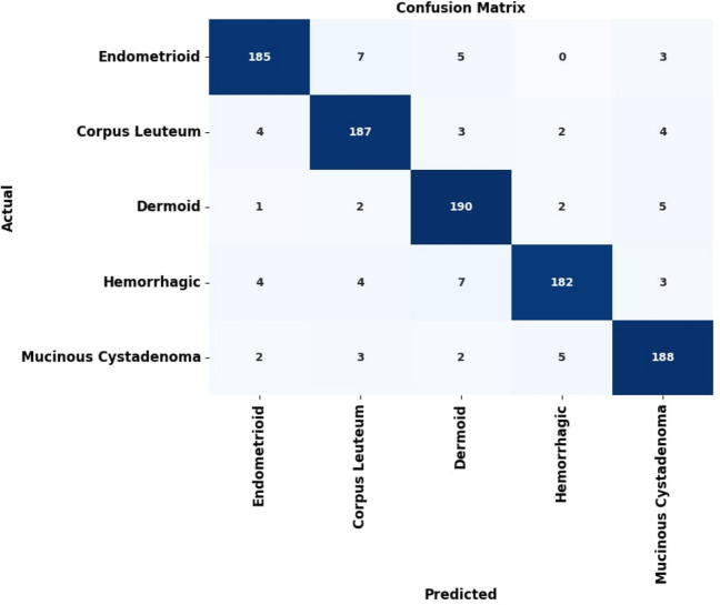 Segmentation of ovarian cyst in ultrasound images using AdaResU-net ...