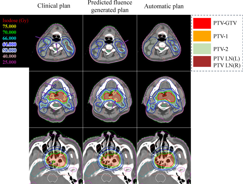 Automatic IMRT treatment planning through fluence prediction and plan ...