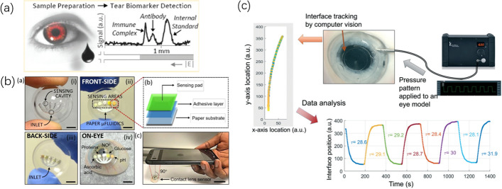 Biomechanical analysis of ocular diseases and its in vitro study ... Biomechanical analysis of ocular diseases and its in vitro study ...