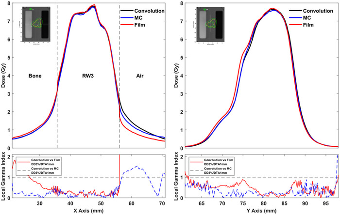 Dosimetric accuracy of the Convolution algorithm for Leksell Gamma Plan radiosurgery treatment ...