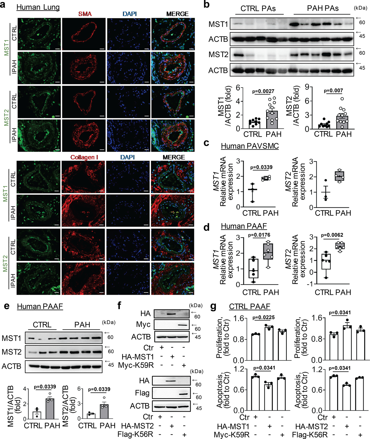 Non Canonical Hippo Mst Signaling Via Bub3 And Foxo Drives Pulmonary