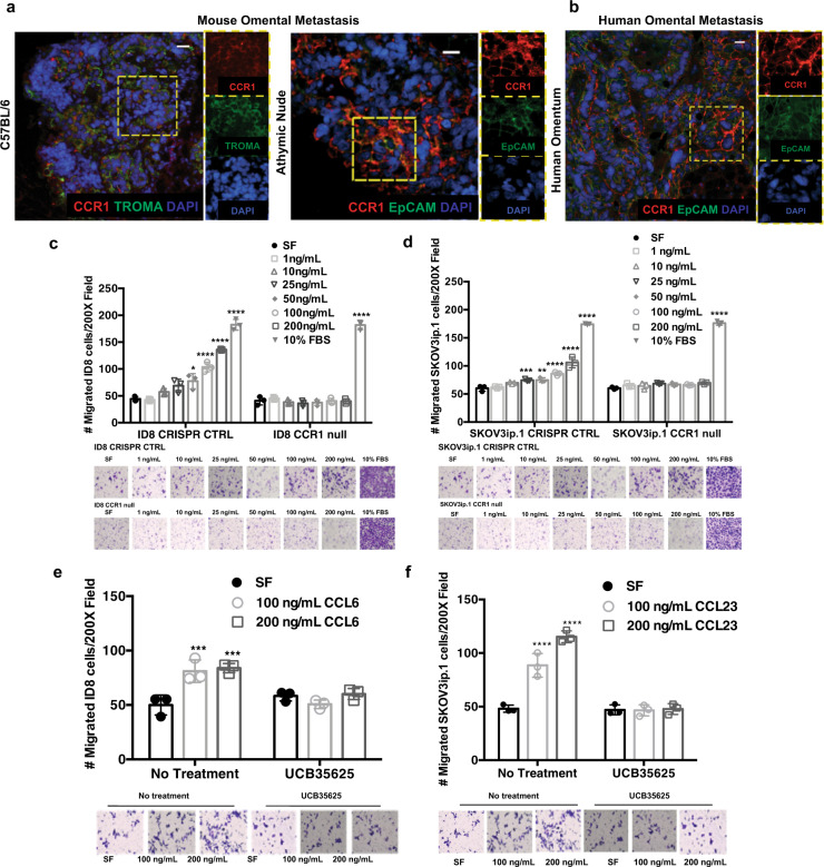 Omental macrophages secrete chemokine ligands that promote ovarian ...