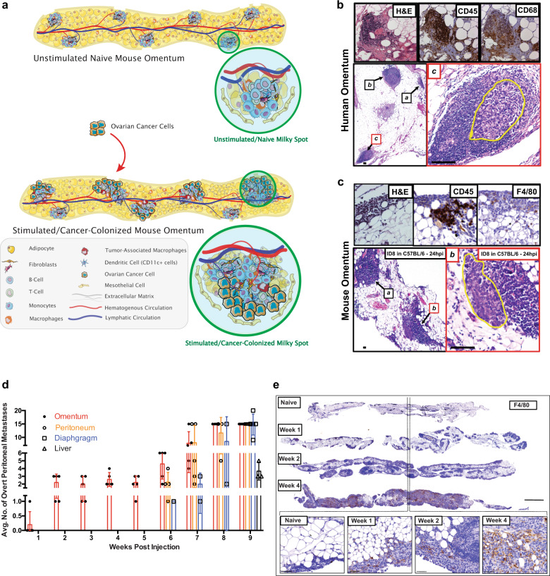 Omental macrophages secrete chemokine ligands that promote ovarian ...