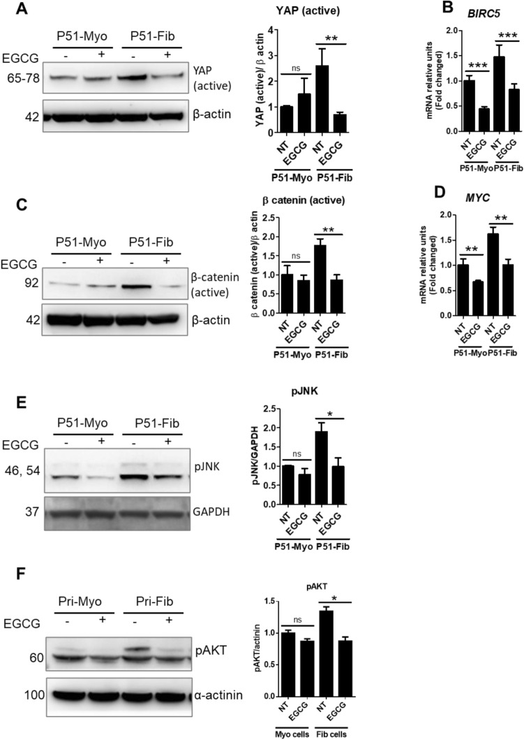 Targeting fibrotic signaling pathways by EGCG as a therapeutic strategy for uterine fibroids - PMC