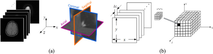 An efficient memory reserving-and-fading strategy for vector quantization based 3D brain ...