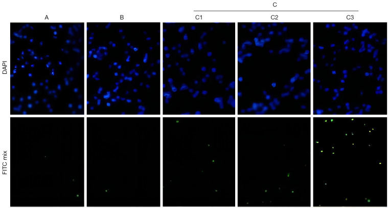 Effect Of Taurine On The Proliferation Apoptosis And Mst1 Hippo