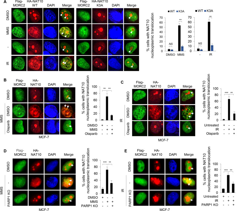 Poly(ADP-ribosyl)ation of acetyltransferase NAT10 by PARP1 is required for its nucleoplasmic ...