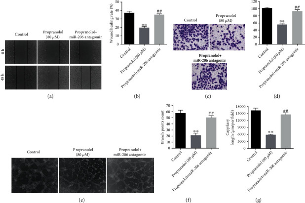 Propranolol Suppresses Proliferation and Migration of HUVECs through ... Propranolol Suppresses Proliferation and Migration of HUVECs through ...