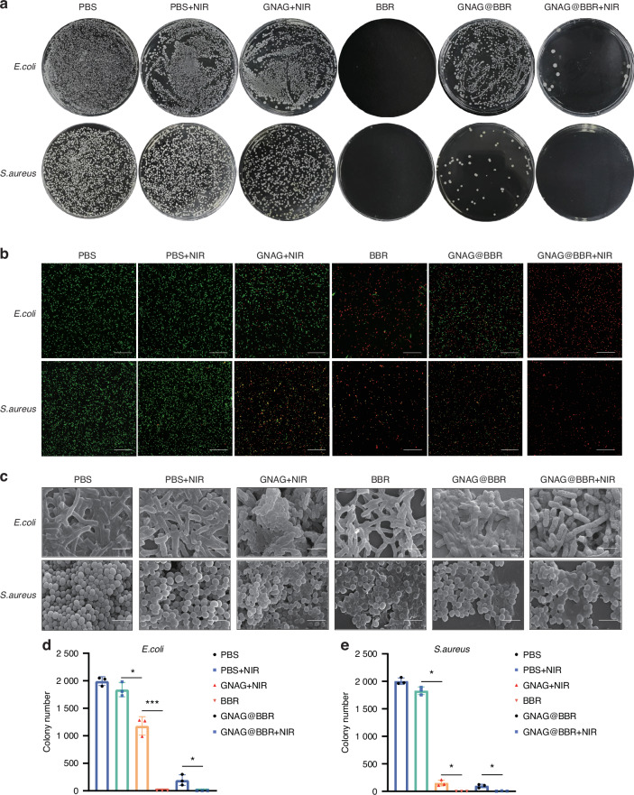 Photothermal Sensitive Nanocomposite Hydrogel For Infectious Bone Defects Pmc