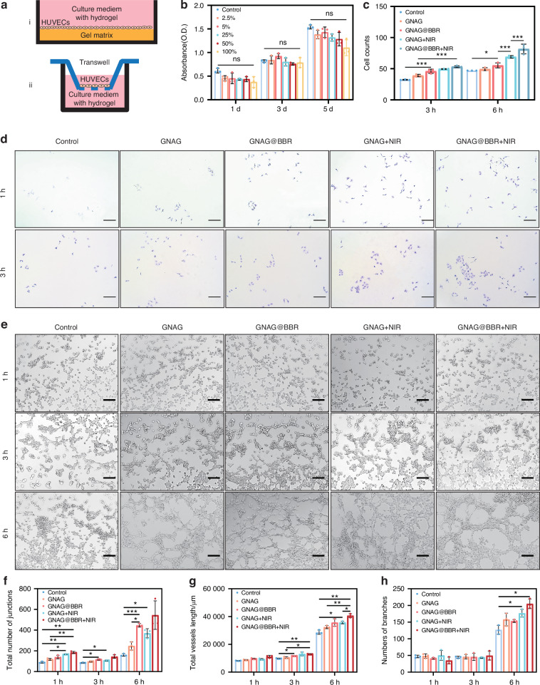 Photothermal Sensitive Nanocomposite Hydrogel For Infectious Bone Defects Pmc