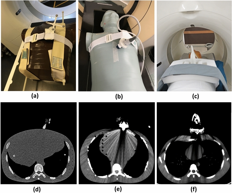 Combined Clustered Scan Based Metal Artifact Reduction Algorithm Ccs Mar For Ultrasound Guided