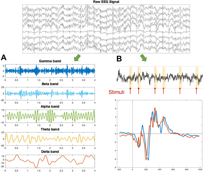 Machine learning in attention-deficit/hyperactivity disorder: new approaches toward ...