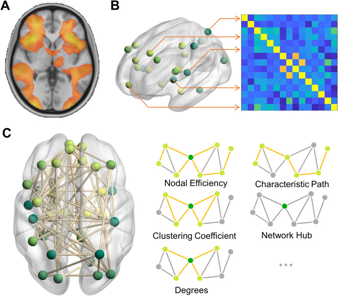 Machine learning in attention-deficit/hyperactivity disorder: new approaches toward ...