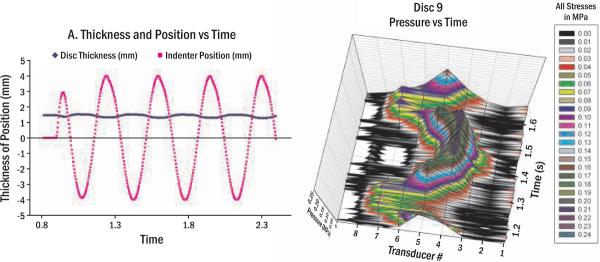 Static and dynamic mechanics of the TMJ: Plowing forces, joint load ...