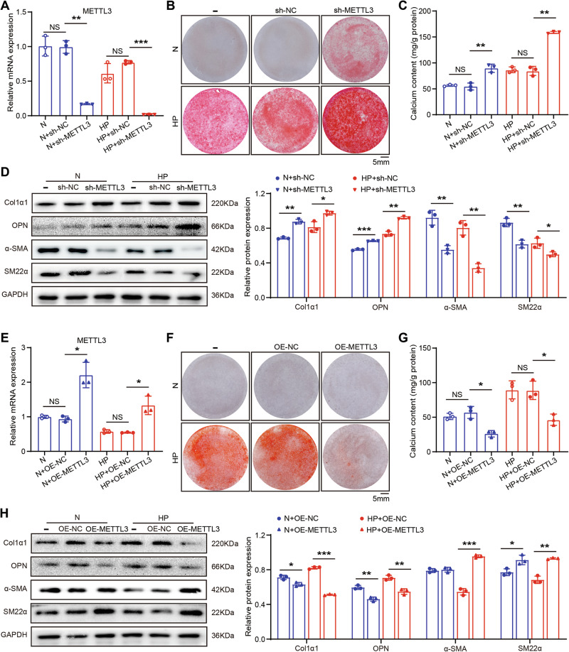 METTL3 obstructs vascular smooth muscle cells osteogenic reprogramming by methylating Runx2 in ...