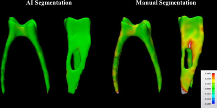 AI-driven segmentation of the pulp cavity system in mandibular molars on CBCT images using ...