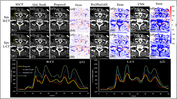 CT-based synthetic contrast-enhanced dual-energy CT generation using ...