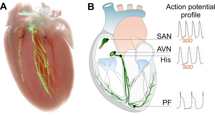 Aging and sinus node dysfunction: mechanisms and future directions - PMC