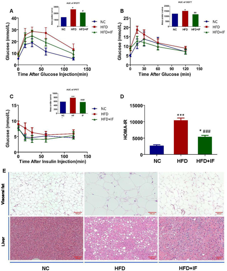 Intermittent fasting regulates gut microbiota and serum metabolome ...