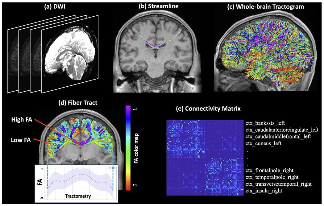Quantitative mapping of the brain’s structural connectivity using diffusion MRI tractography: A ...