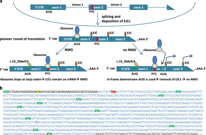 Homozygous frame shift variant in ATP7B exon 1 leads to bypass of nonsense-mediated mRNA decay ...