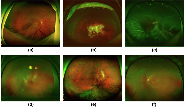 Open ultrawidefield fundus image dataset with disease diagnosis and ...