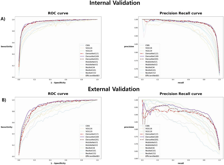 Deep learning model for tongue cancer diagnosis using endoscopic images - PMC