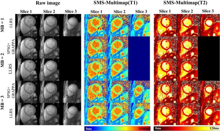 Simultaneous multislice cardiac multimapping based on locally low-rank and sparsity constraints ...