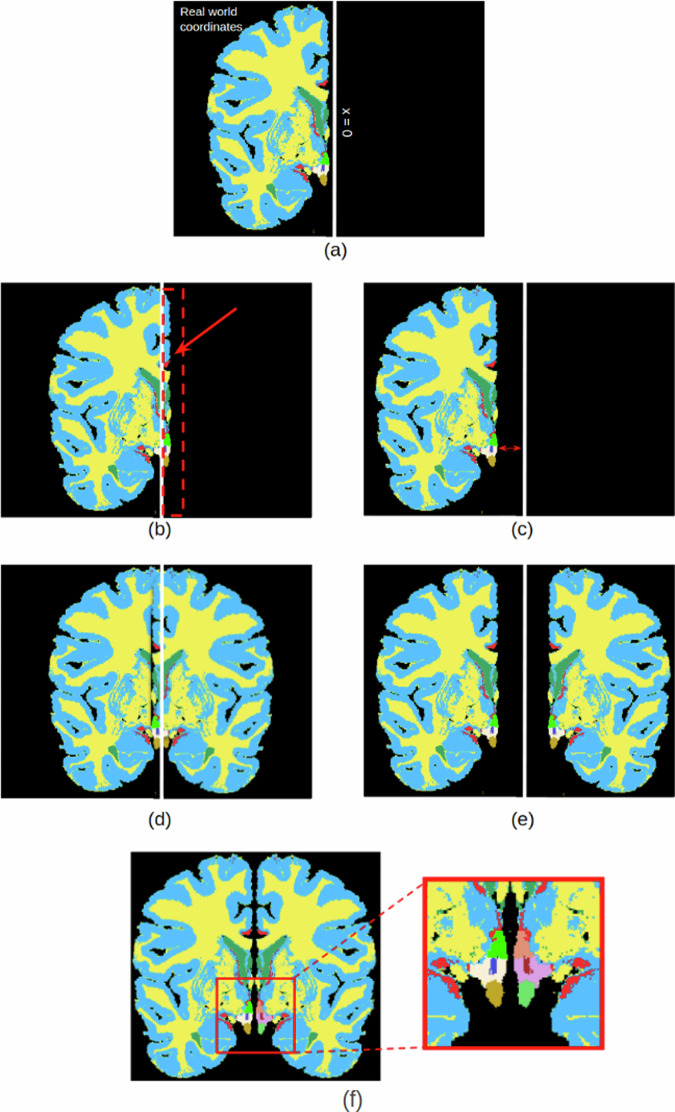 High-resolution segmentations of the hypothalamus and its subregions for training of ...