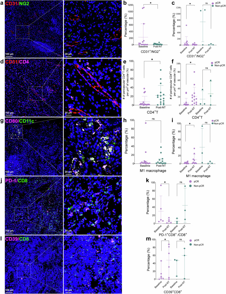 Perioperative Sintilimab And Neoadjuvant Anlotinib Plus Chemotherapy For Resectable Non Small