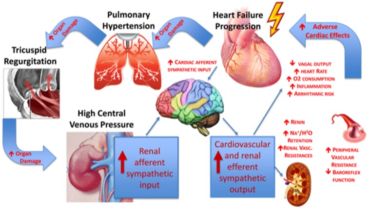 Sympathetic activation in heart failure - PMC Sympathetic activation in heart failure - PMC