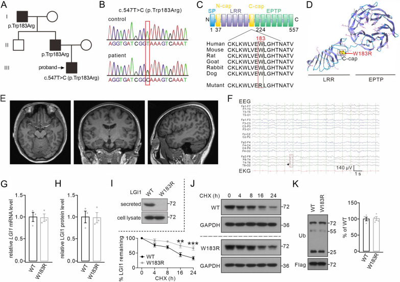 A patient-derived mutation of epilepsy-linked LGI1 increases seizure susceptibility through ...