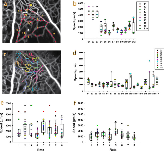 Quantitative study of spatial and temporal variation in retinal capillary network perfusion in ...