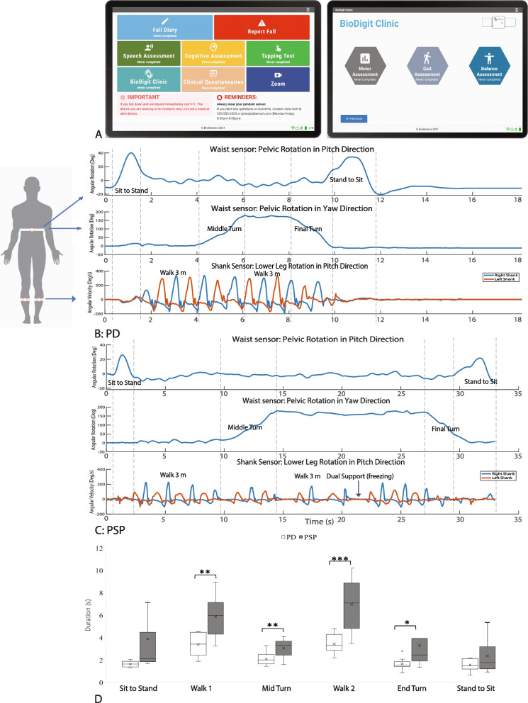 Remote at-home wearable-based gait assessments in Progressive ...