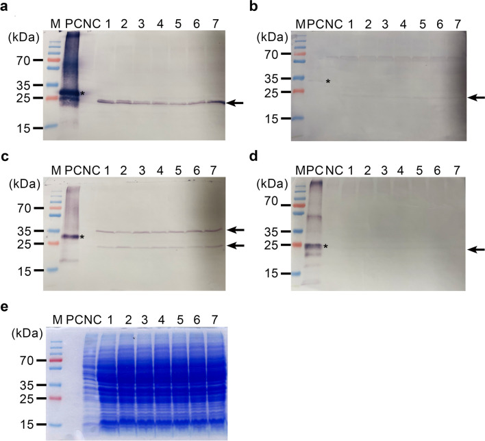 Expression of virus-like particles (VLPs) of foot-and-mouth disease virus (FMDV) using ...
